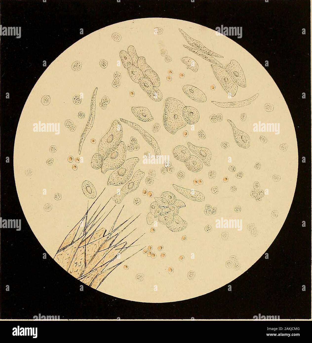 An atlas of clinical microscopy . ine of pyelitis is alwaysacid, and ...