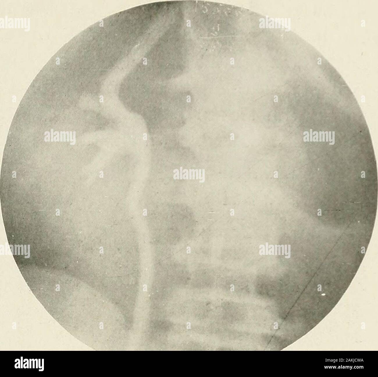 Pyelography (pyelo-ureterography) a study of the normal and pathologic ...