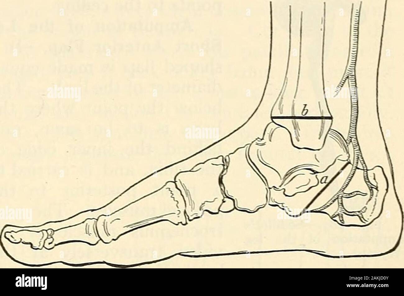 Bony projection hi-res stock photography and images - Alamy