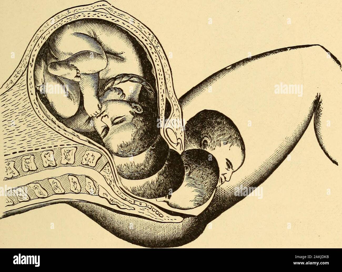 External rotation of the thigh hi-res stock photography and images - Alamy