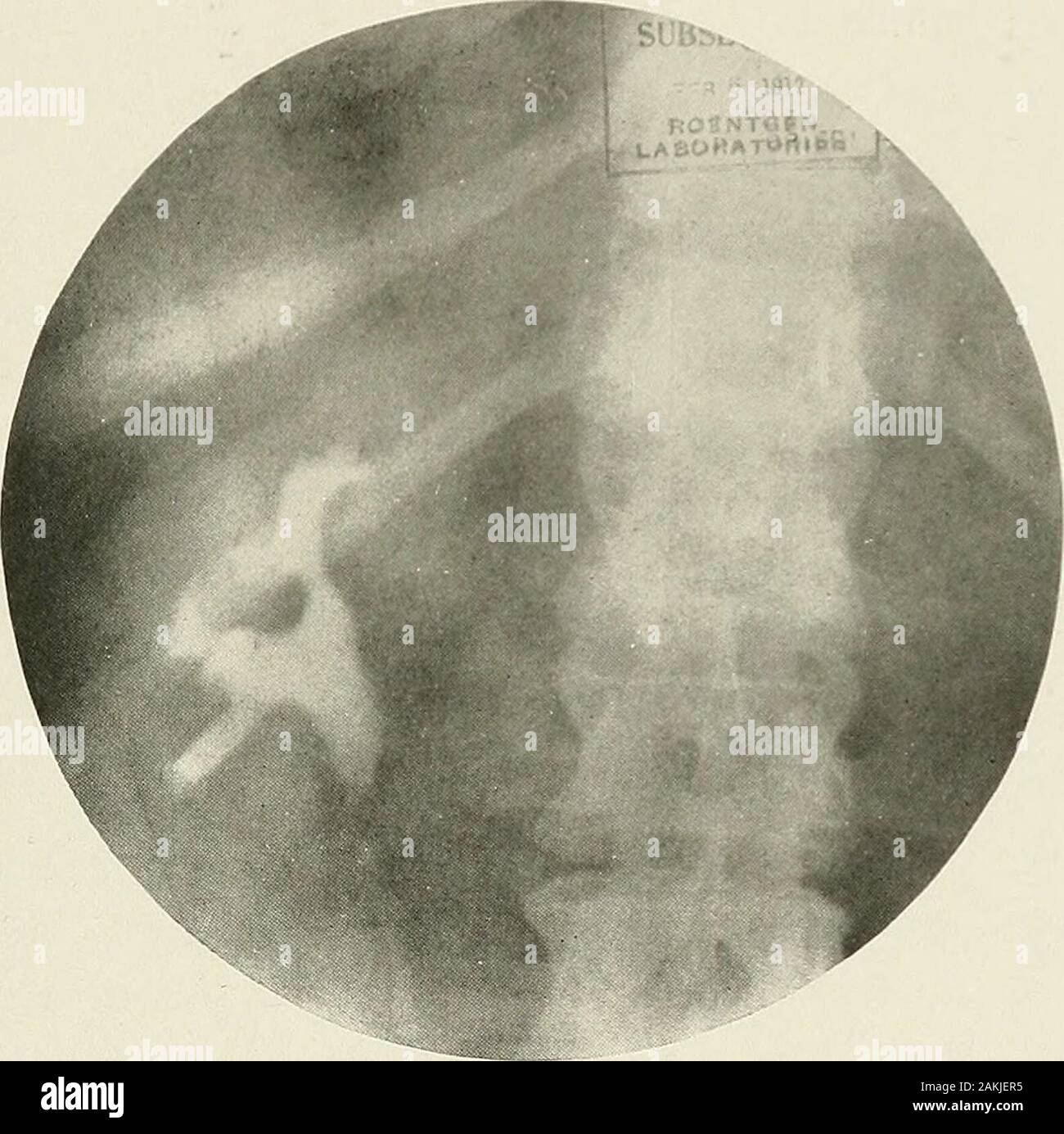 Pyelography (pyelo-ureterography) a study of the normal and pathologic ...