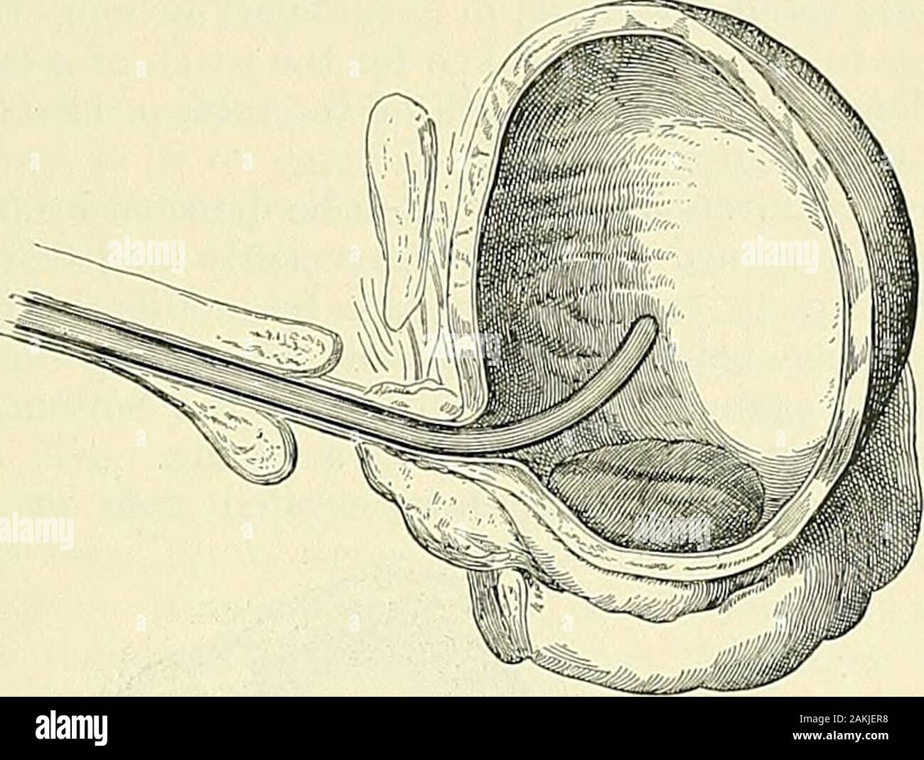 Fluid sounding hi-res stock photography and images - Alamy