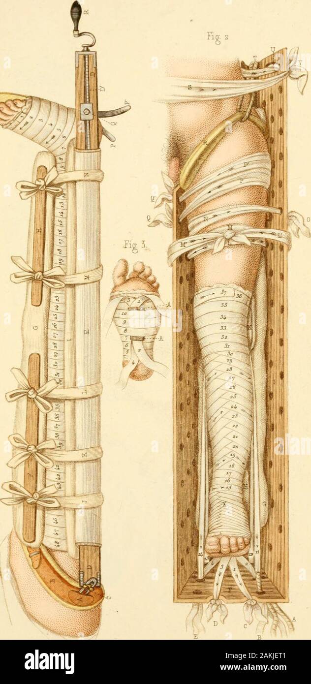 [Manual of surgical bandages, devices and dressings . c^TT Stock Photo ...