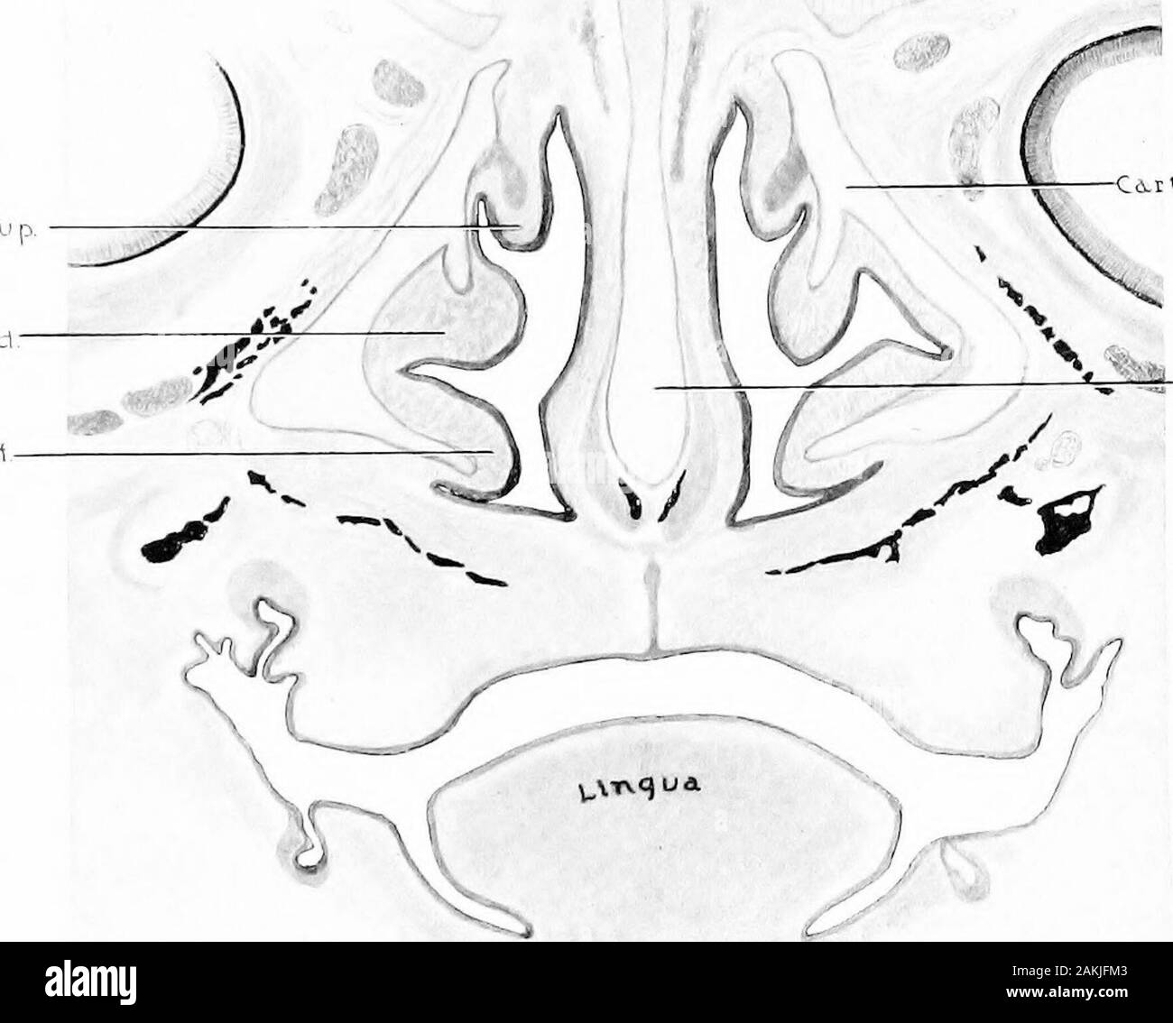 Development and anatomy of the nasal accessory sinuses in man ...