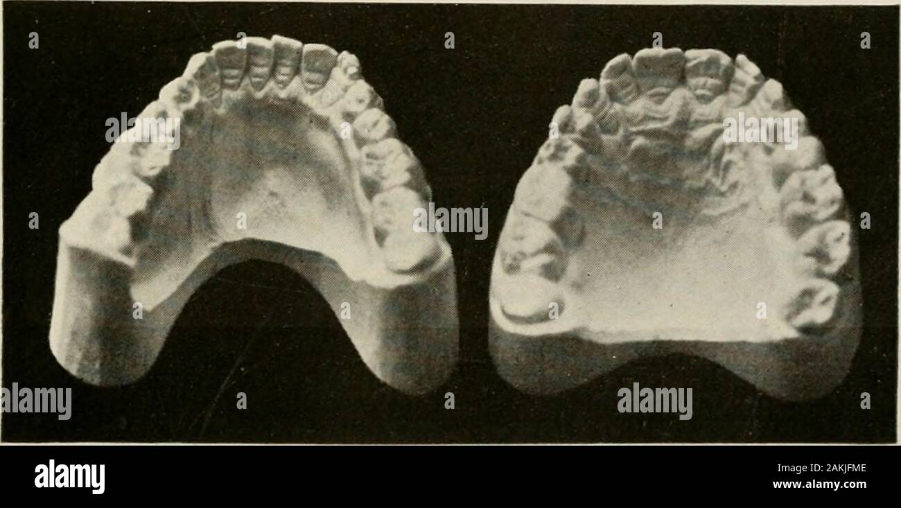General and dental pathology with special reference to etiology and ...