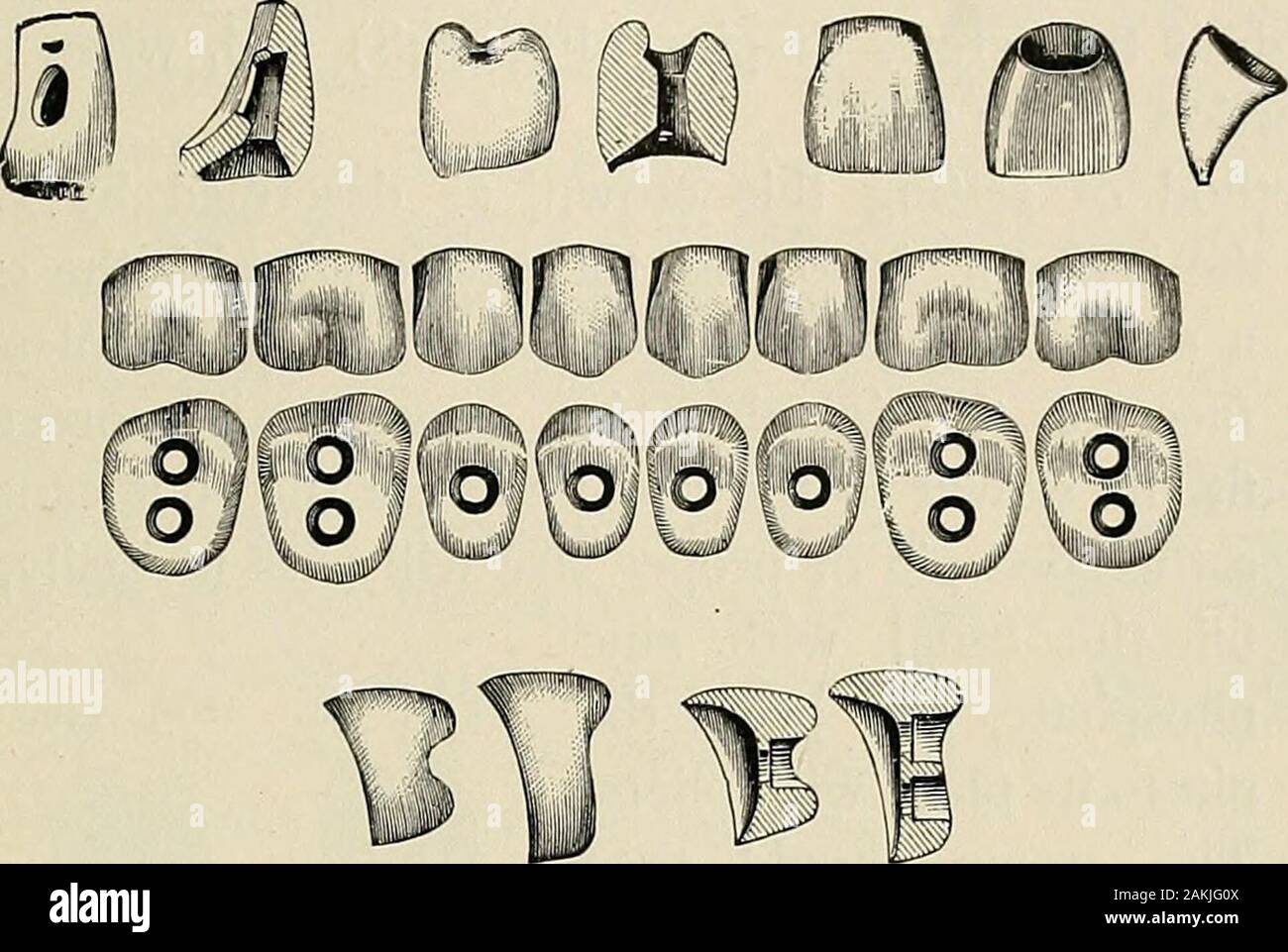 Amalgam Cement High Resolution Stock Photography and Images - Alamy