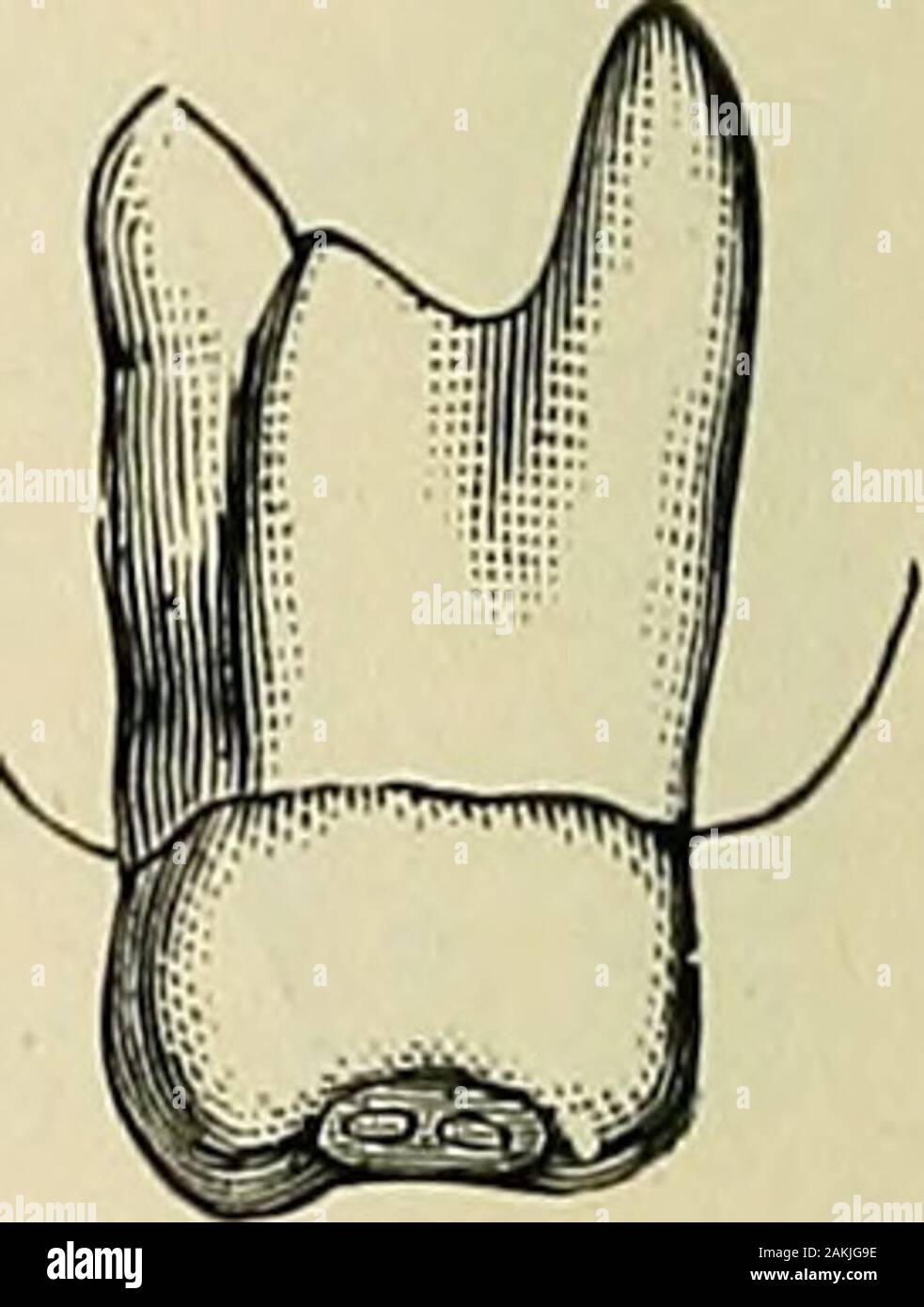 Amalgam Cement High Resolution Stock Photography and Images - Alamy