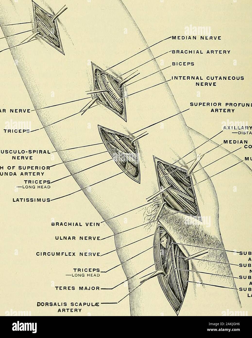Ulnar nerve surgery hi-res stock photography and images - Alamy