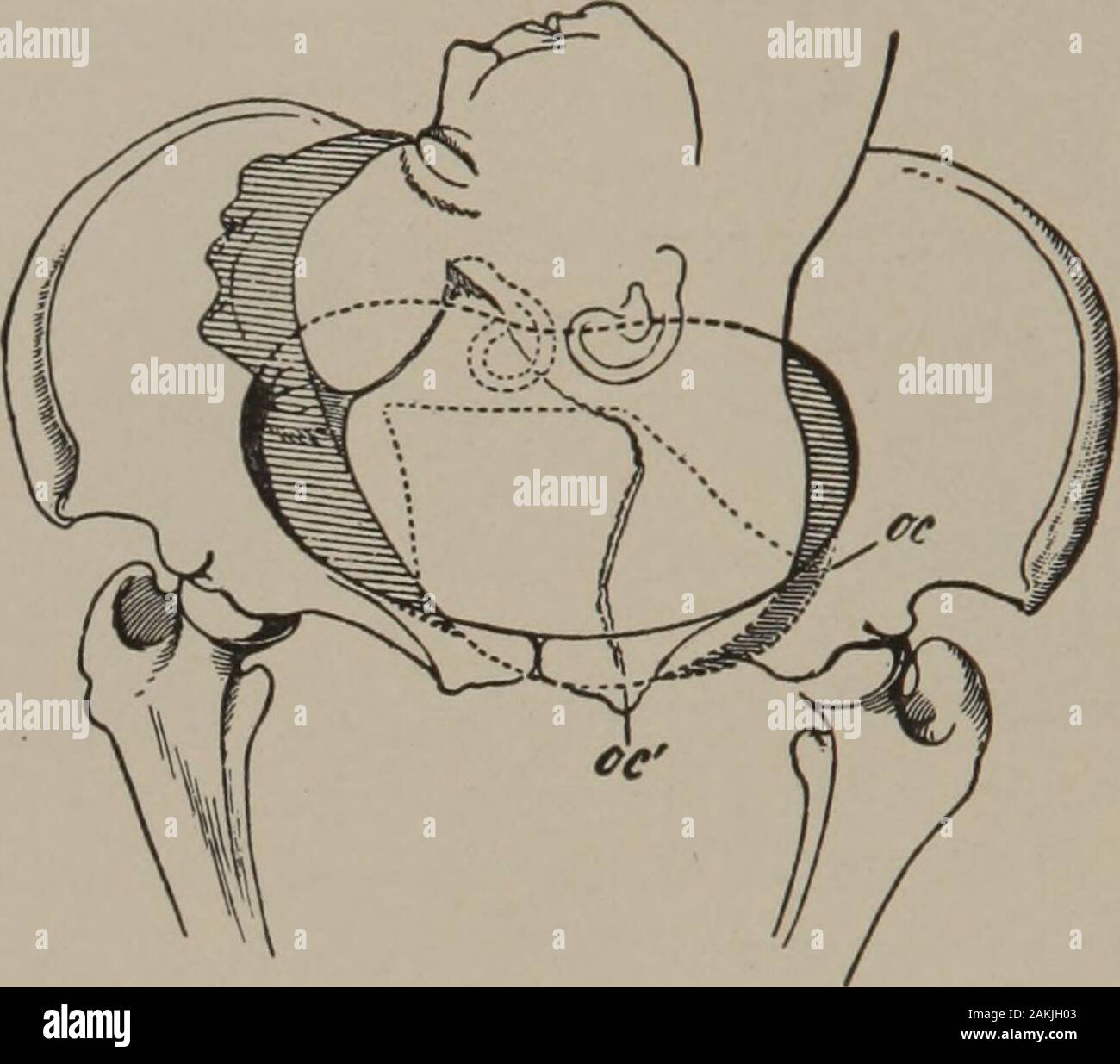 Occiput posterior hi-res stock photography and images - Alamy