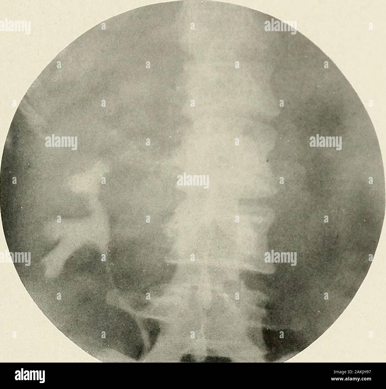Pyelography (pyelo-ureterography) a study of the normal and pathologic ...