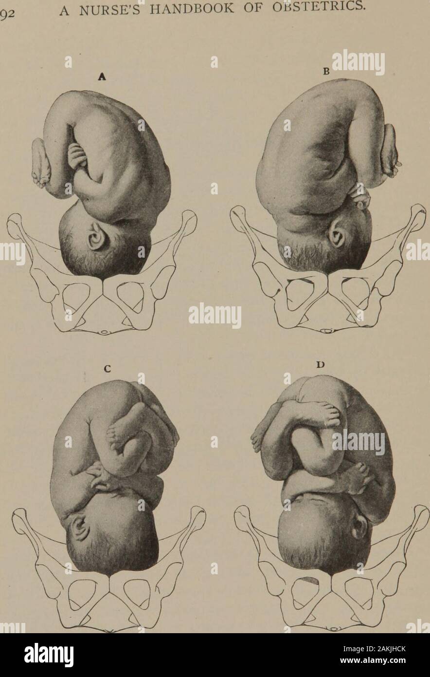 Resistant forces hi-res stock photography and images - Alamy