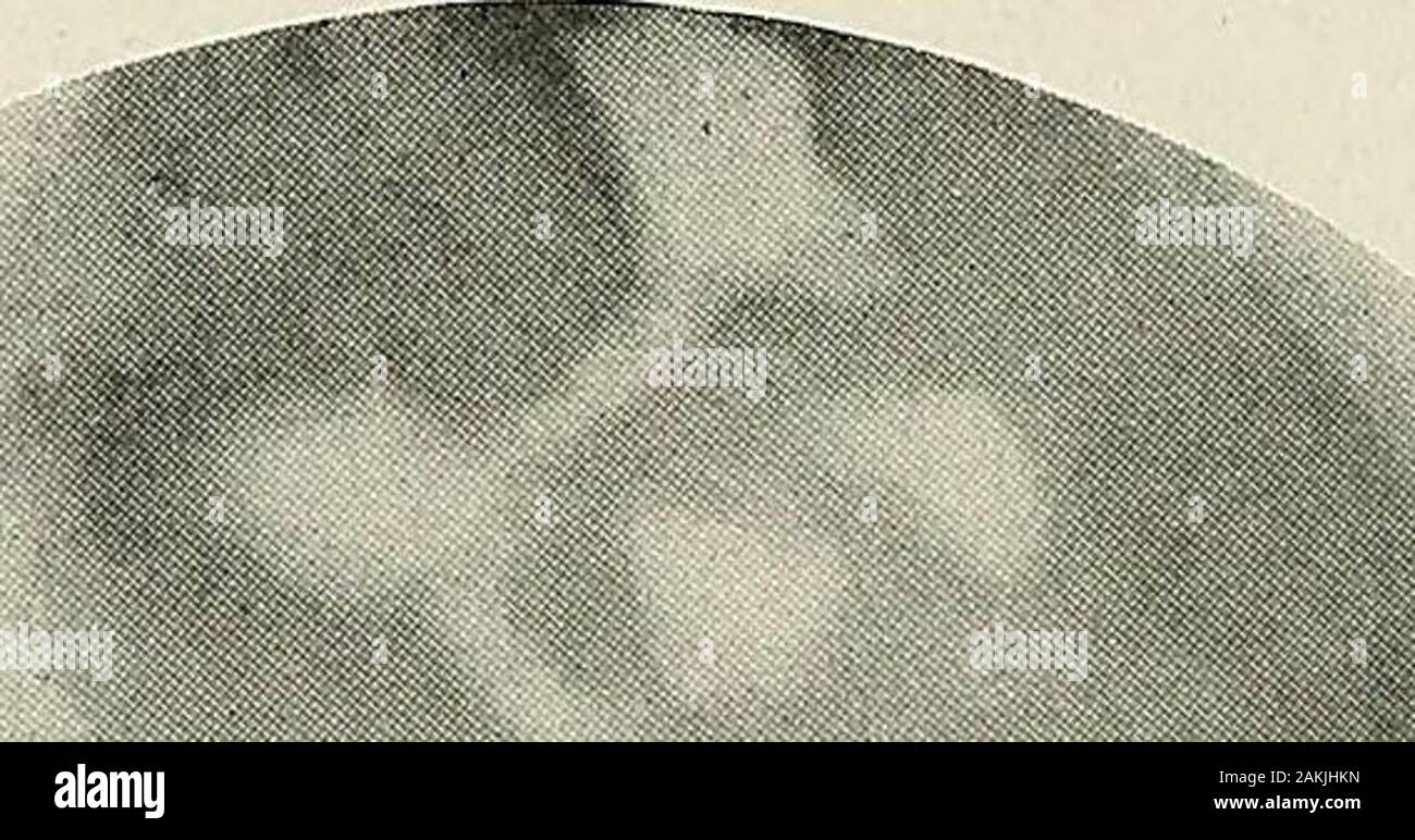 Pyelography (pyelo-ureterography) a study of the normal and pathologic ...