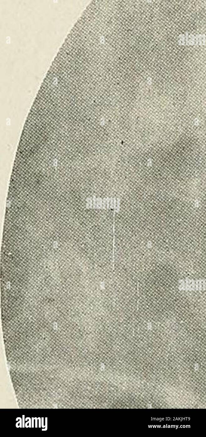 Pyelography (pyelo-ureterography) a study of the normal and pathologic ...