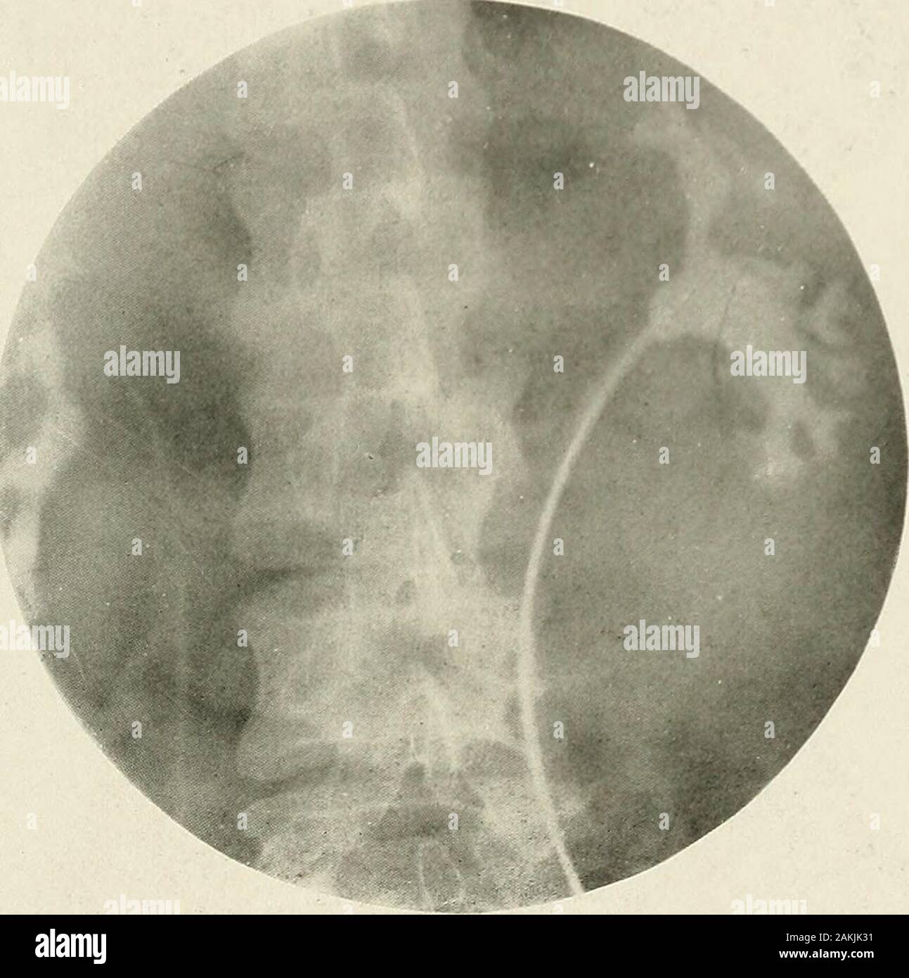 Major calyx hi-res stock photography and images - Alamy