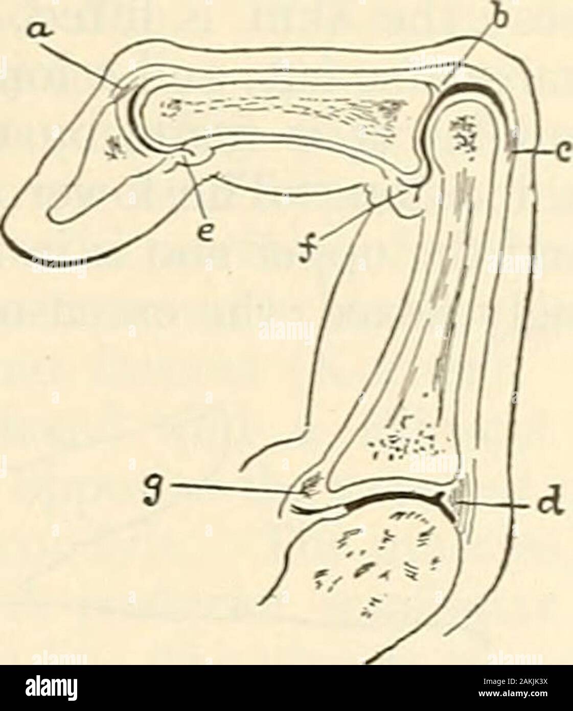 Modern surgery, general and operative . ting through the skin and subcu ...