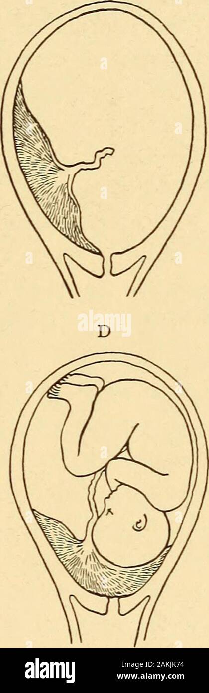 Placental attachment hi-res stock photography and images - Alamy