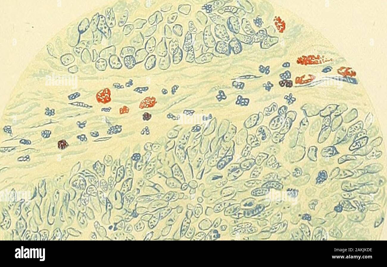Urinary bladder epithelial cells hi-res stock photography and images ...