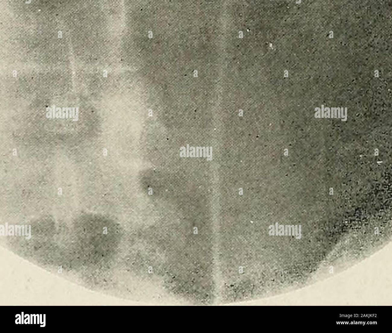 Pyelography (pyelo-ureterography) a study of the normal and pathologic ...
