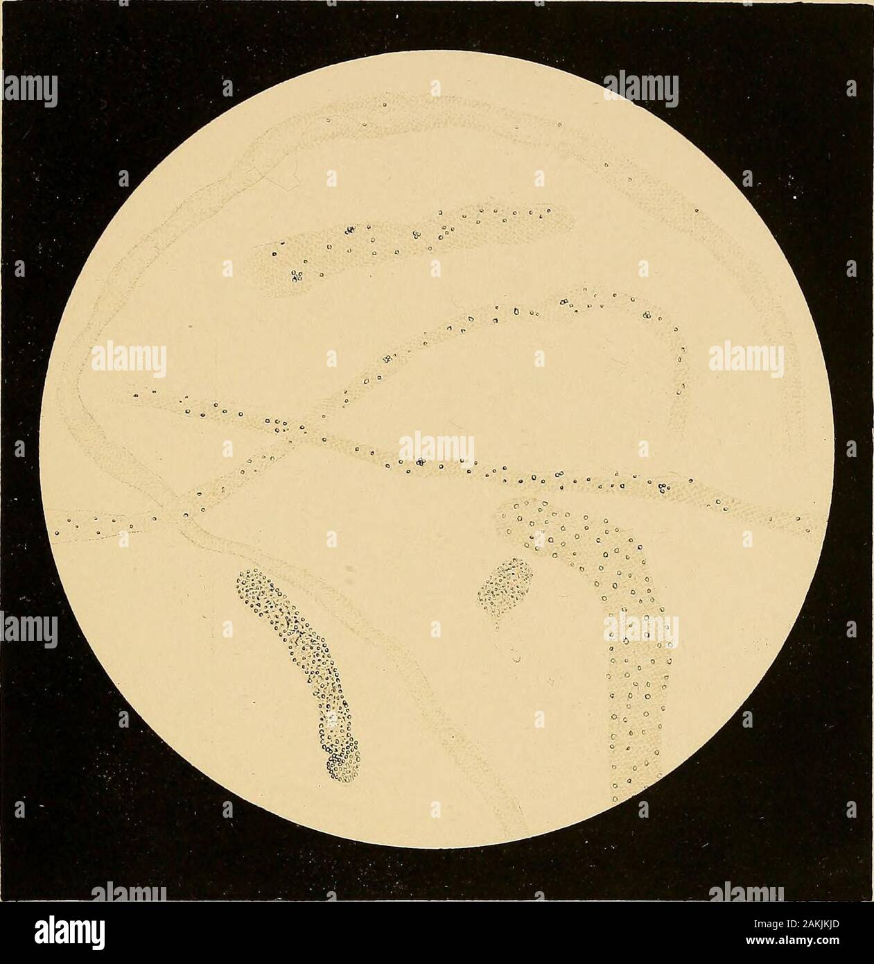 An atlas of clinical microscopy . Mezger Ulk. AVax casts Peyers ...