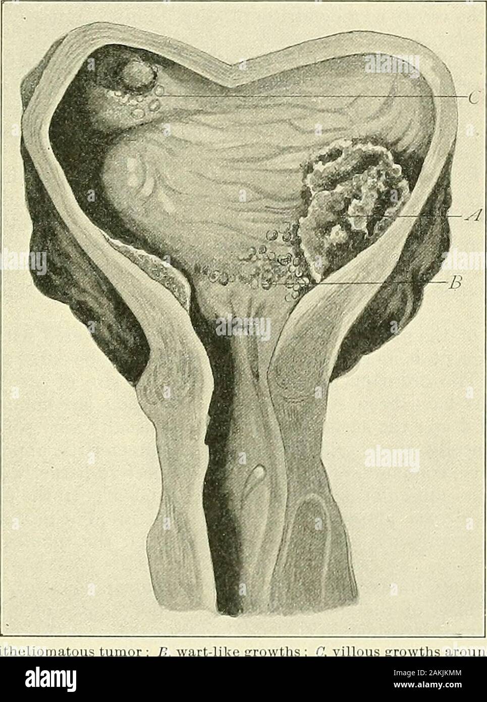 Gross Human Diseases