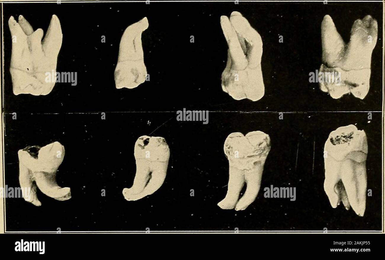 Principles and practice of operative dentistry . tent of ...