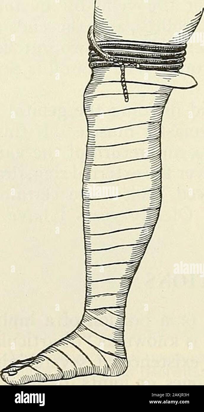 Modern surgery, general and operative . should notbe freely or forcibly ...