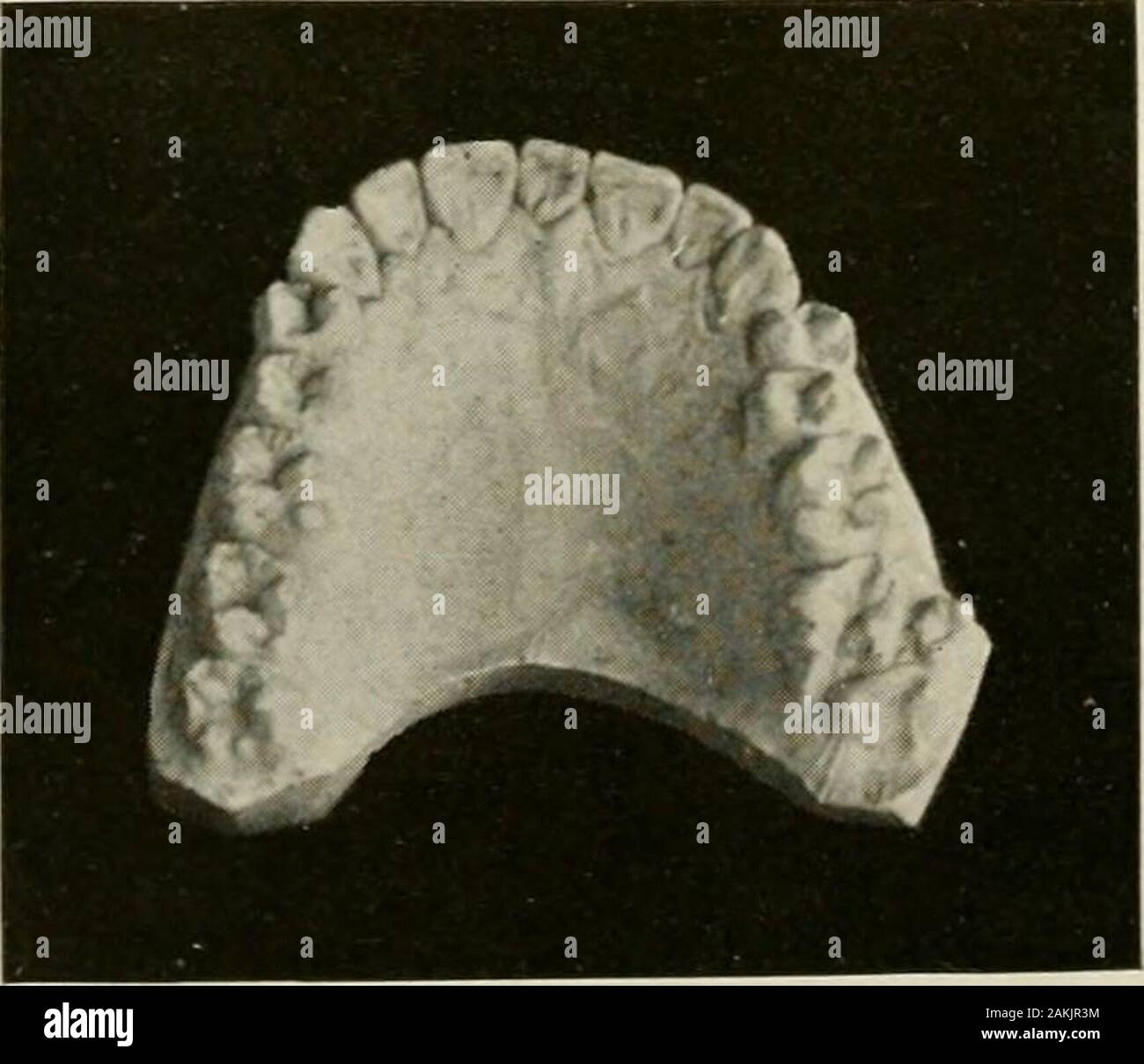 Peg teeth hi-res stock photography and images - Alamy