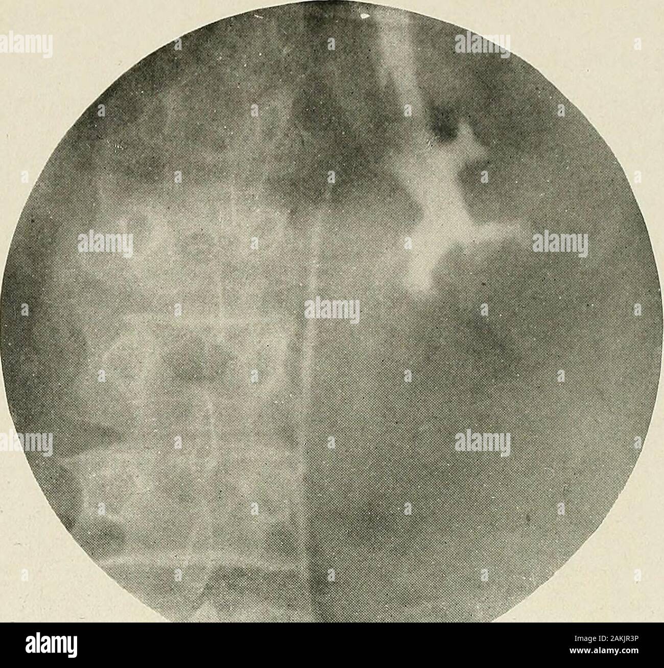 Pyelography (pyelo-ureterography) a study of the normal and pathologic ...