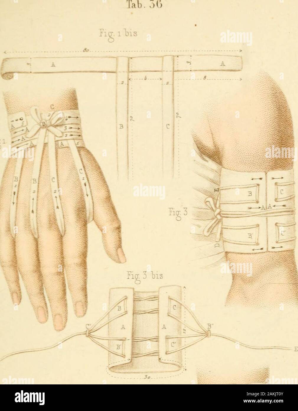 [Manual of surgical bandages, devices and dressings Stock Photo - Alamy