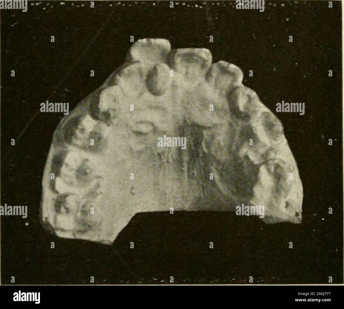 General and dental pathology with special reference to etiology and ...