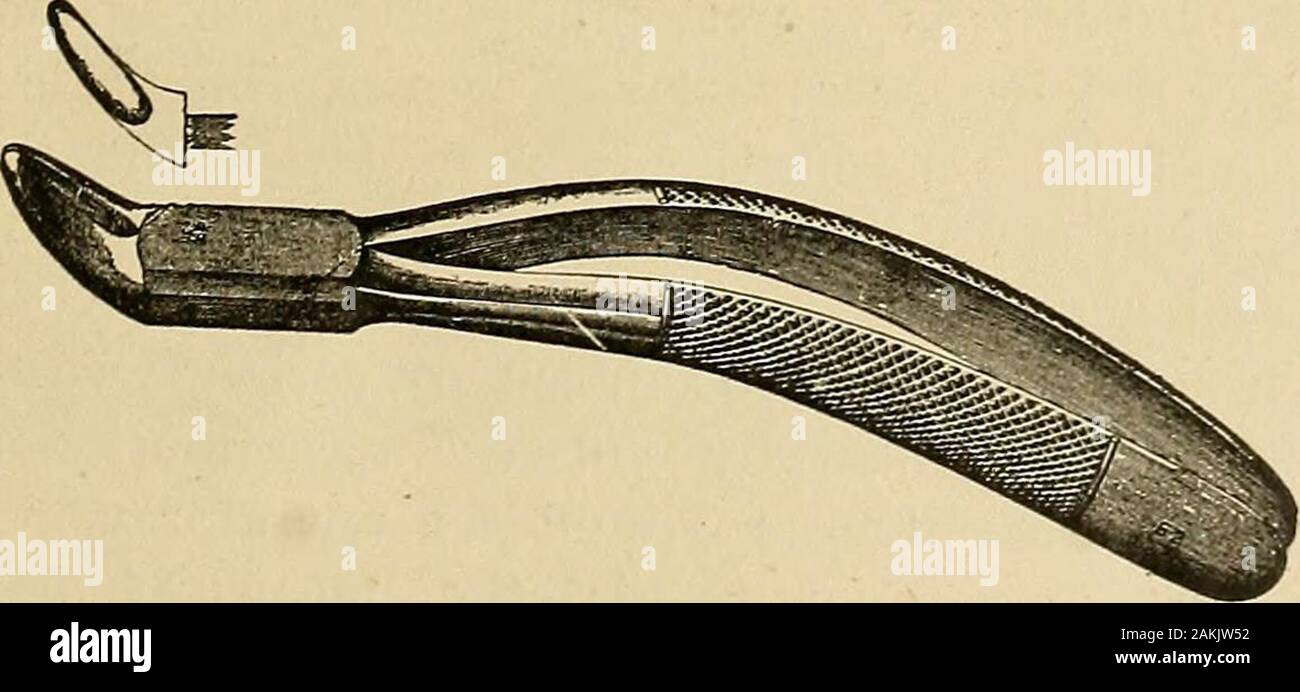 Principles and practice of operative dentistry . Deciduous superior ...