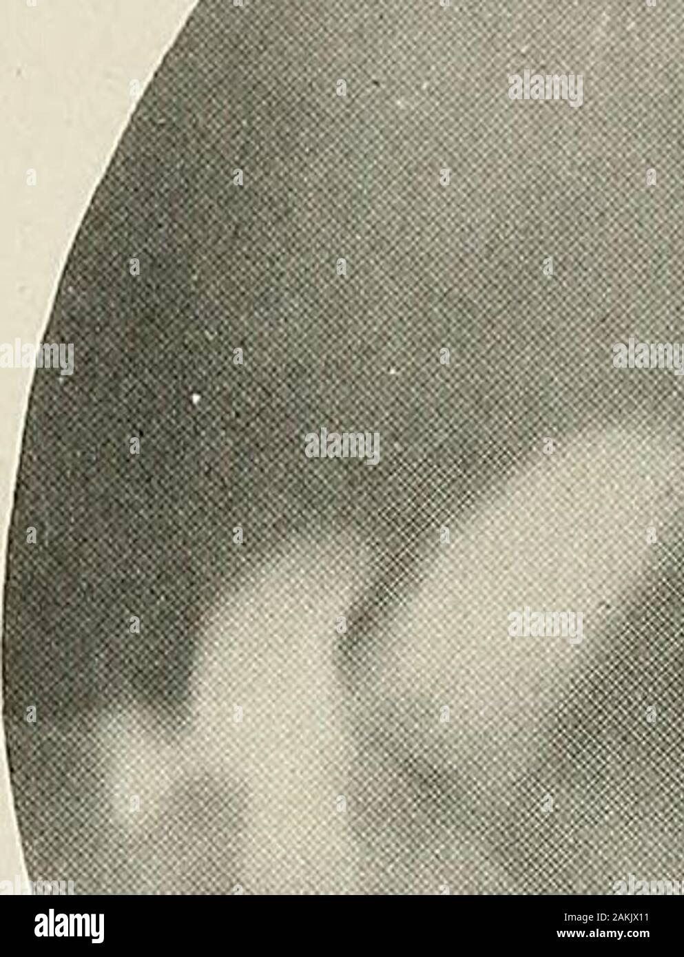 Pyelography (pyelo-ureterography) a study of the normal and pathologic ...