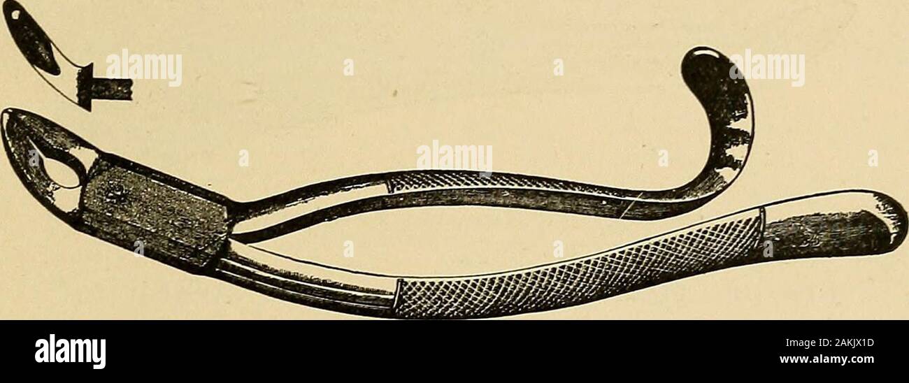 Principles and practice of operative dentistry . Deciduous inferior ...