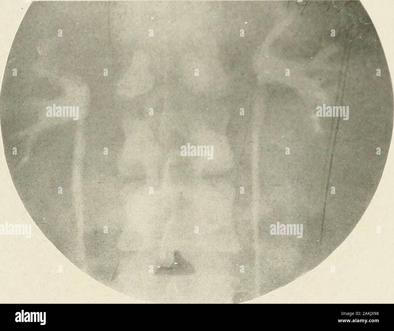 Pyelography (pyelo-ureterography) a study of the normal and pathologic ...