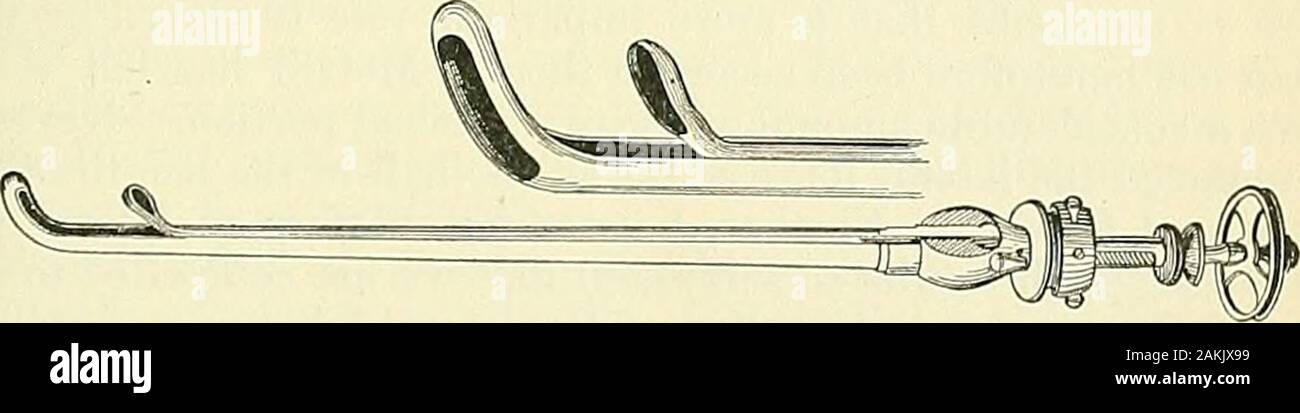 Suprapubic hi-res stock photography and images - Alamy