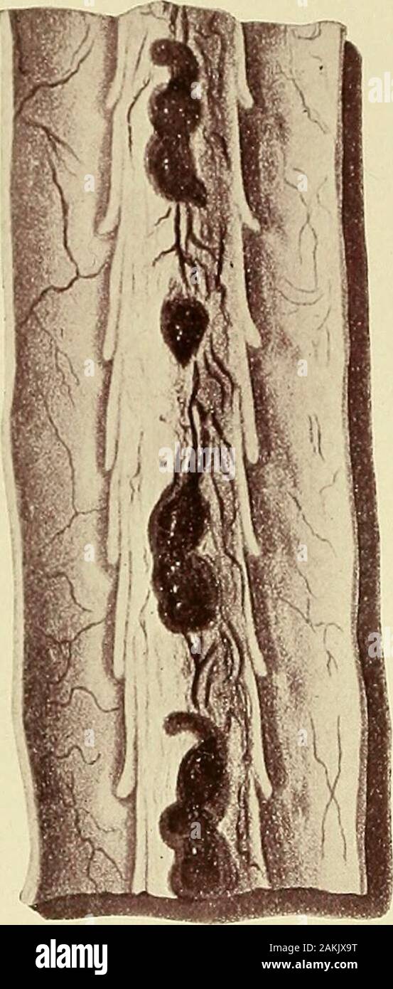 Leeches and adults hi-res stock photography and images - Alamy