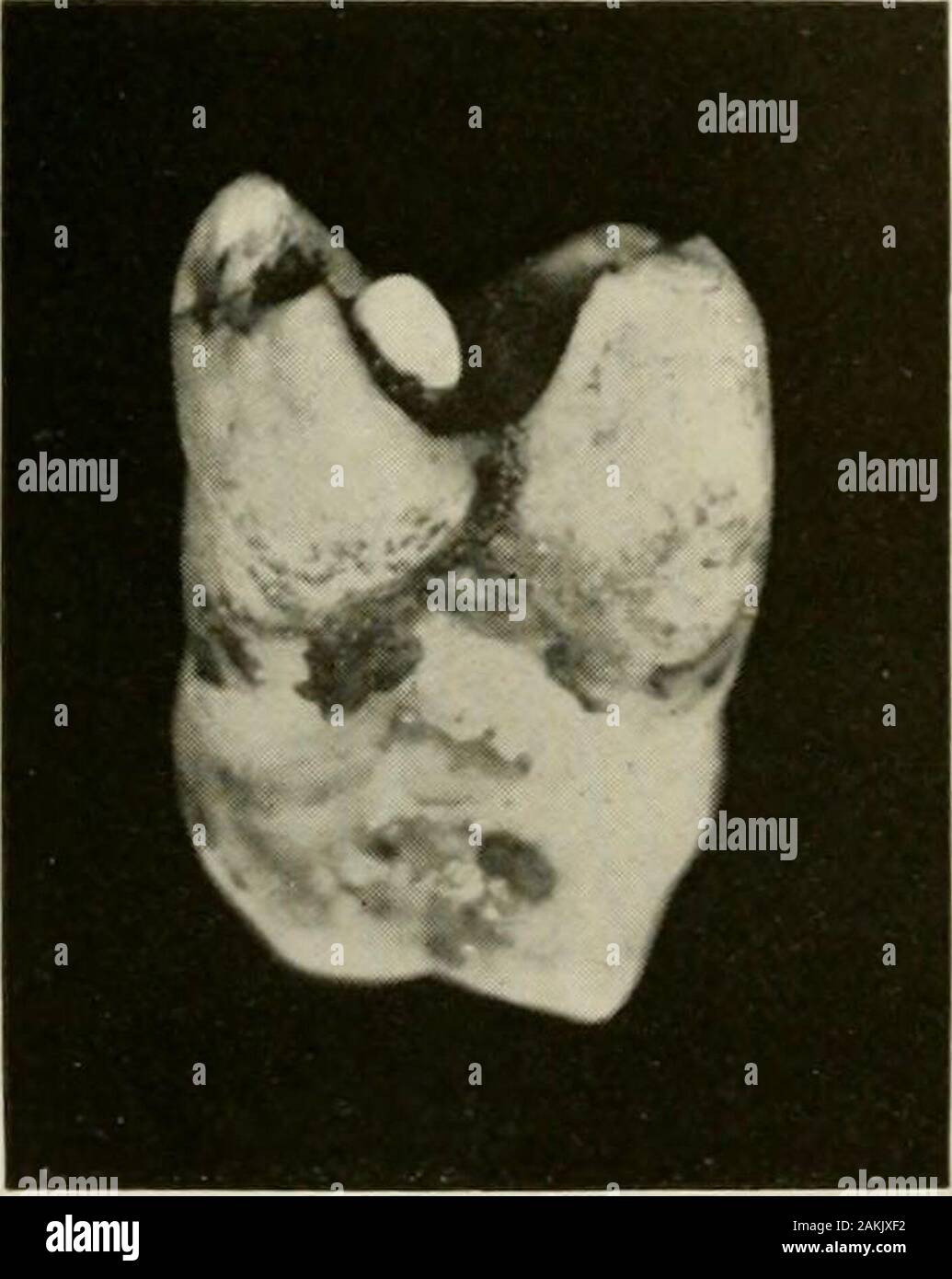 General and dental pathology with special reference to etiology and ...