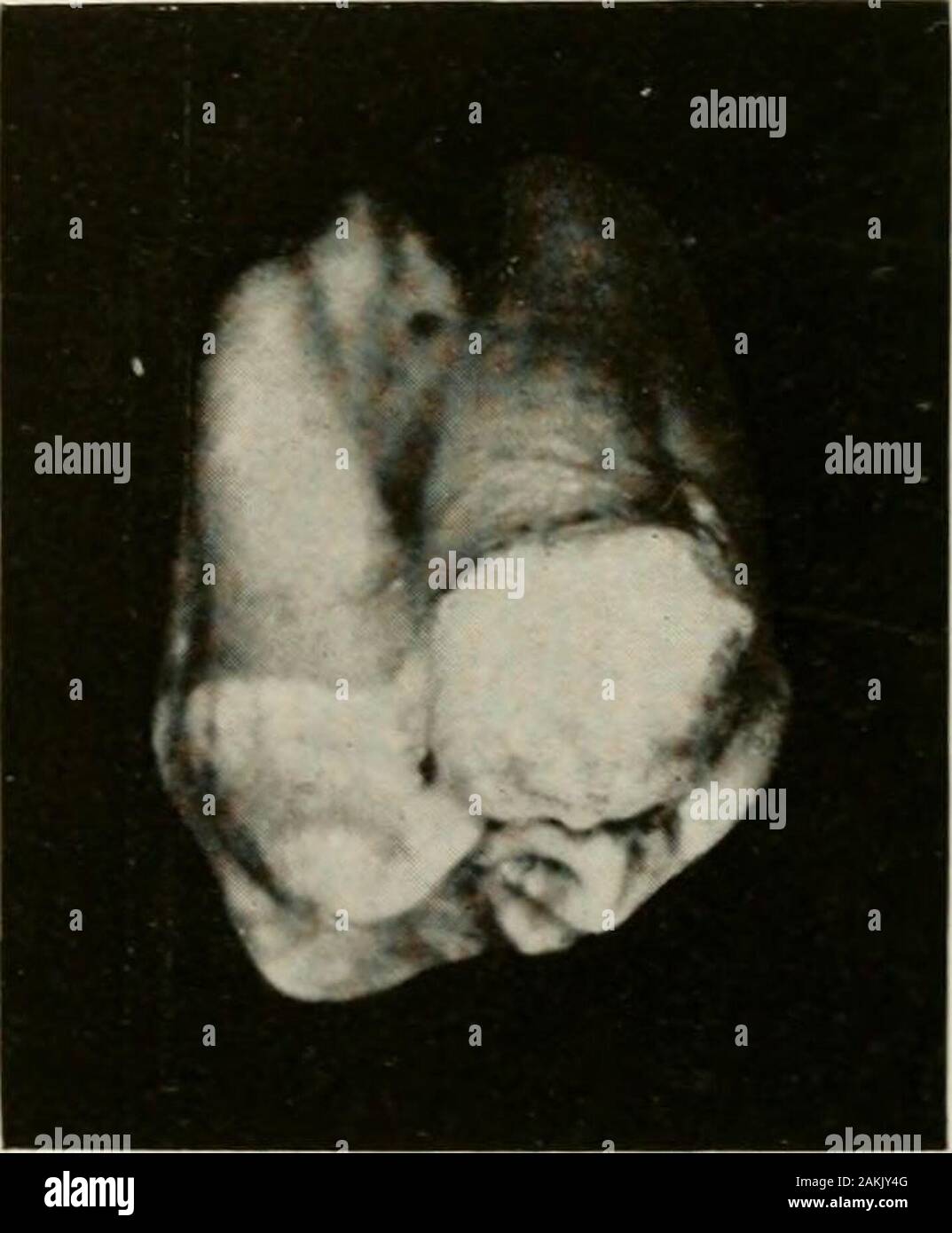 General and dental pathology with special reference to etiology and ...
