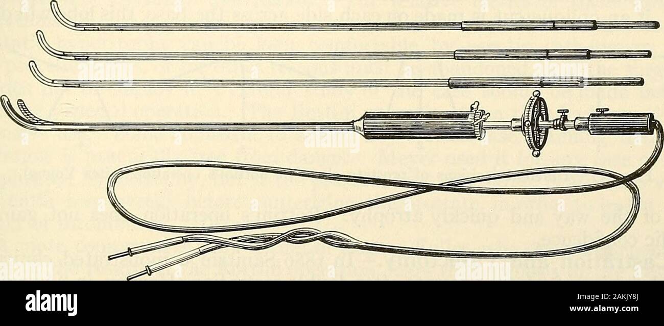 Modern surgery, general and operative . also enucleated. The bladder is ...