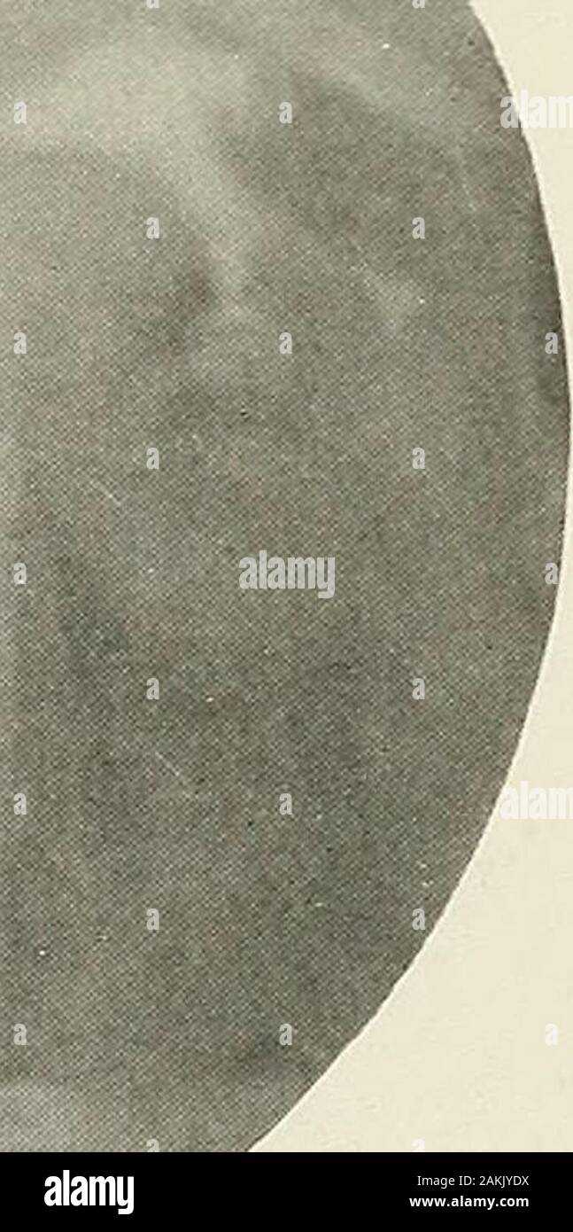Pyelography (pyelo-ureterography) a study of the normal and pathologic ...