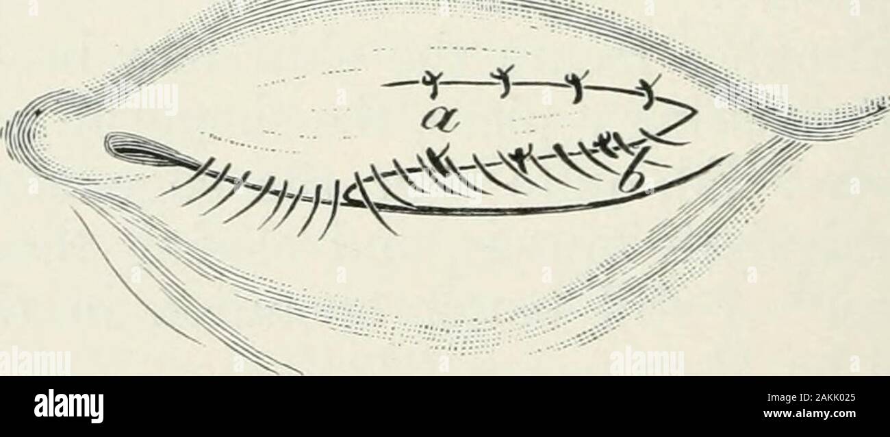 Eyelash follicle hi-res stock photography and images - Alamy