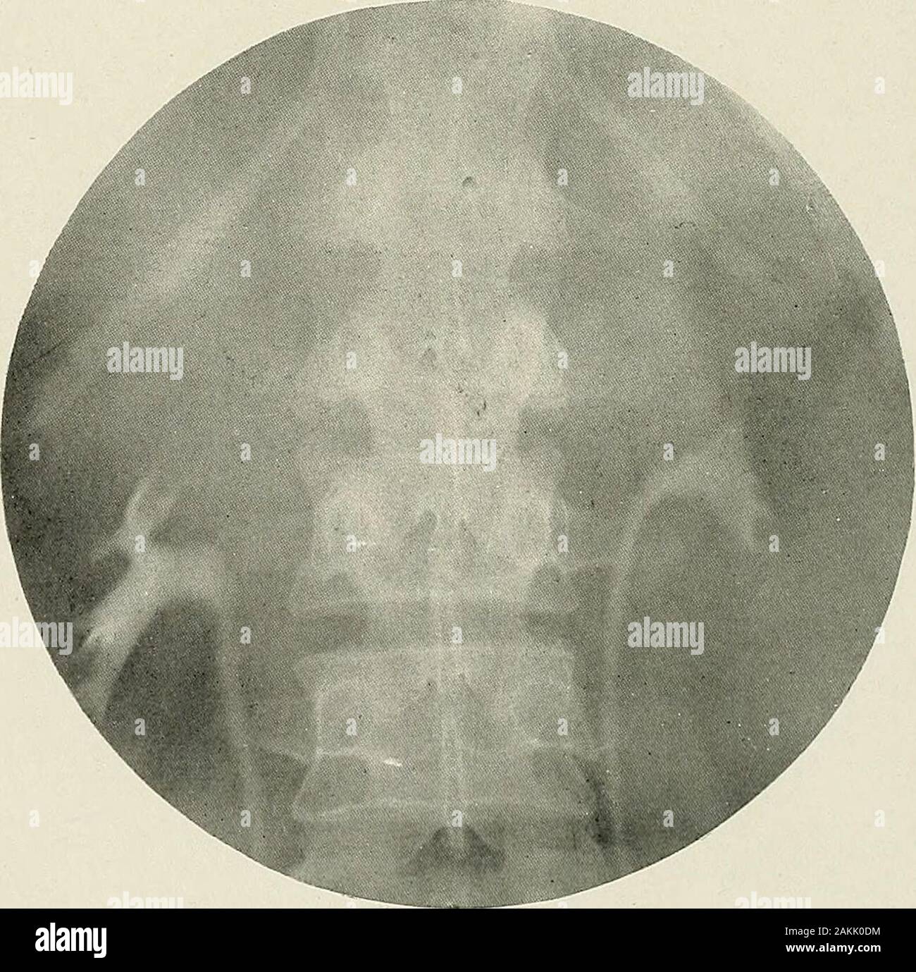 Pyelography (pyelo-ureterography) a study of the normal and pathologic ...