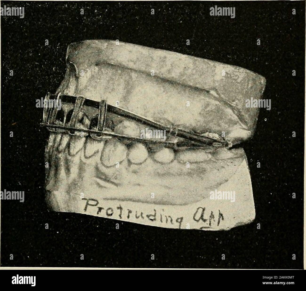 Two forward teeth hi-res stock photography and images - Alamy