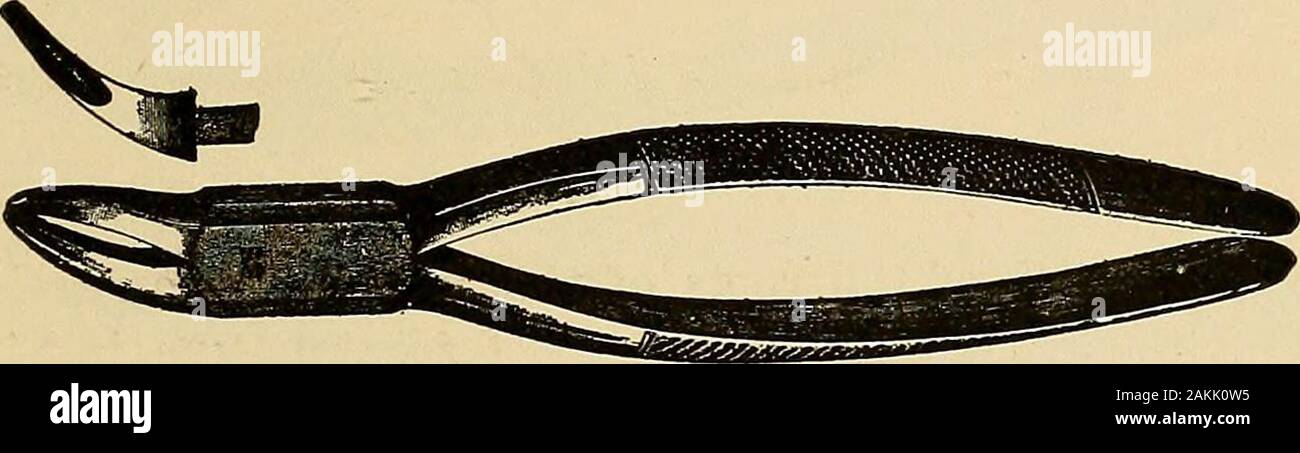 Principles and practice of operative dentistry . Superior anterior root ...