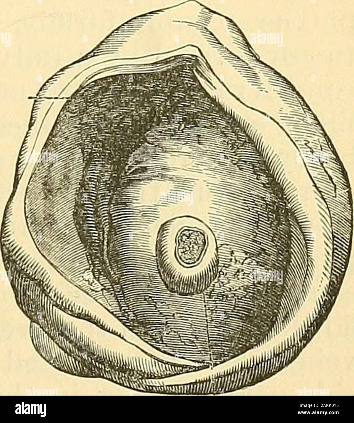 Remarkable surgery hi-res stock photography and images - Alamy