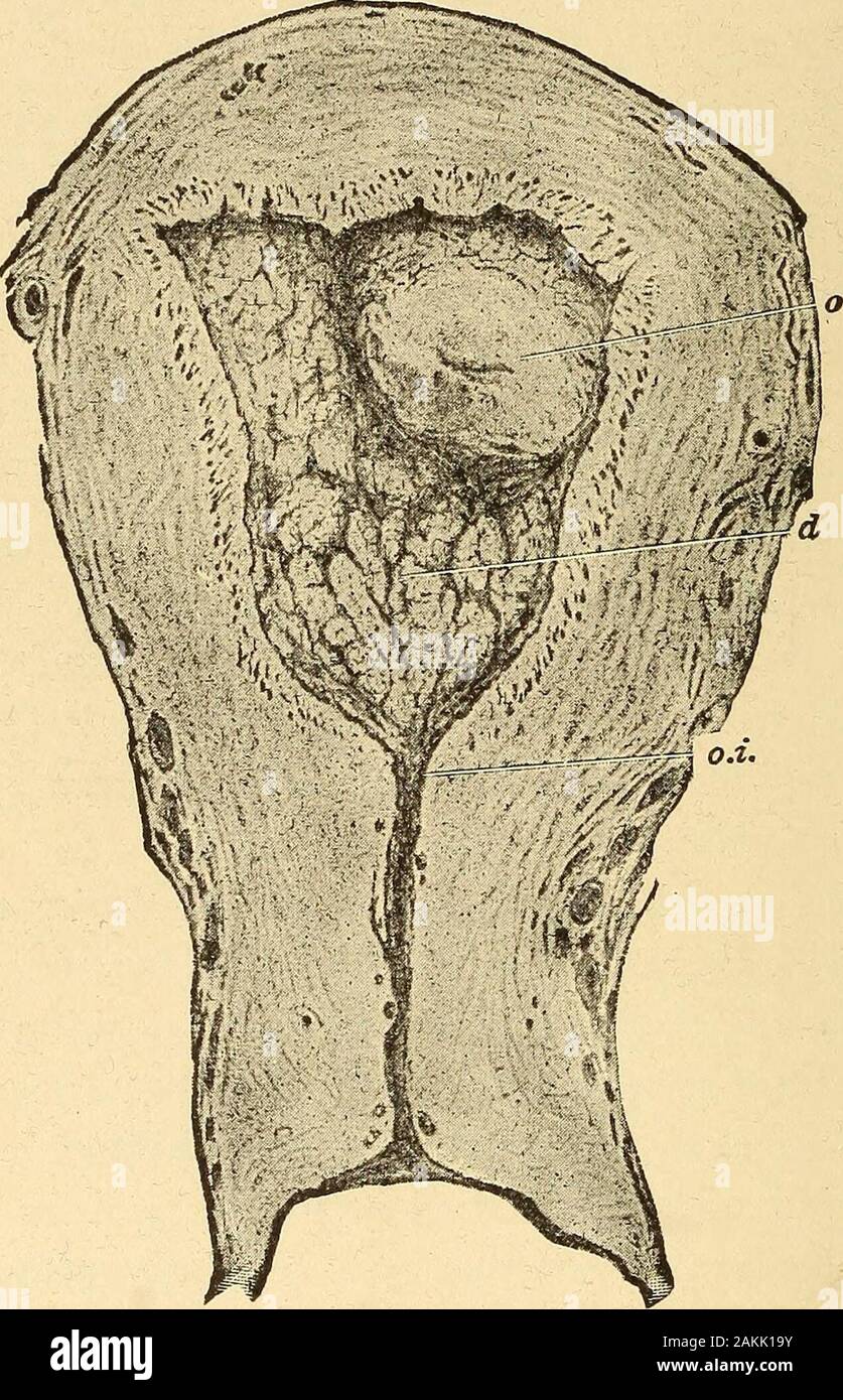 Decidua capsularis hi-res stock photography and images - Alamy