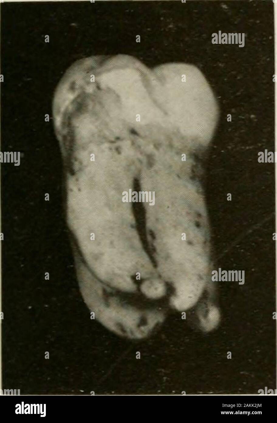 General and dental pathology with special reference to etiology and ...