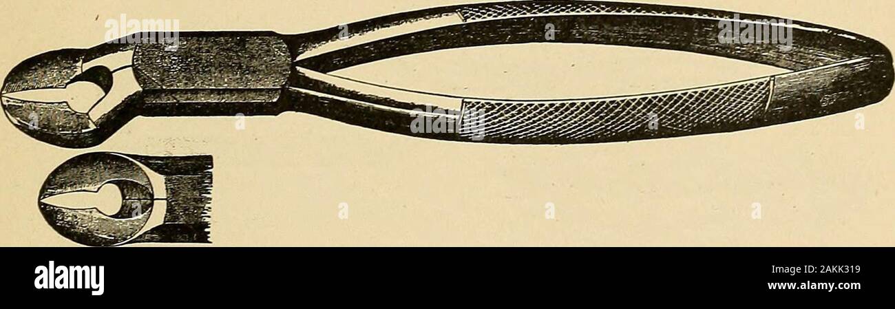 Approximating forceps hi-res stock photography and images - Alamy