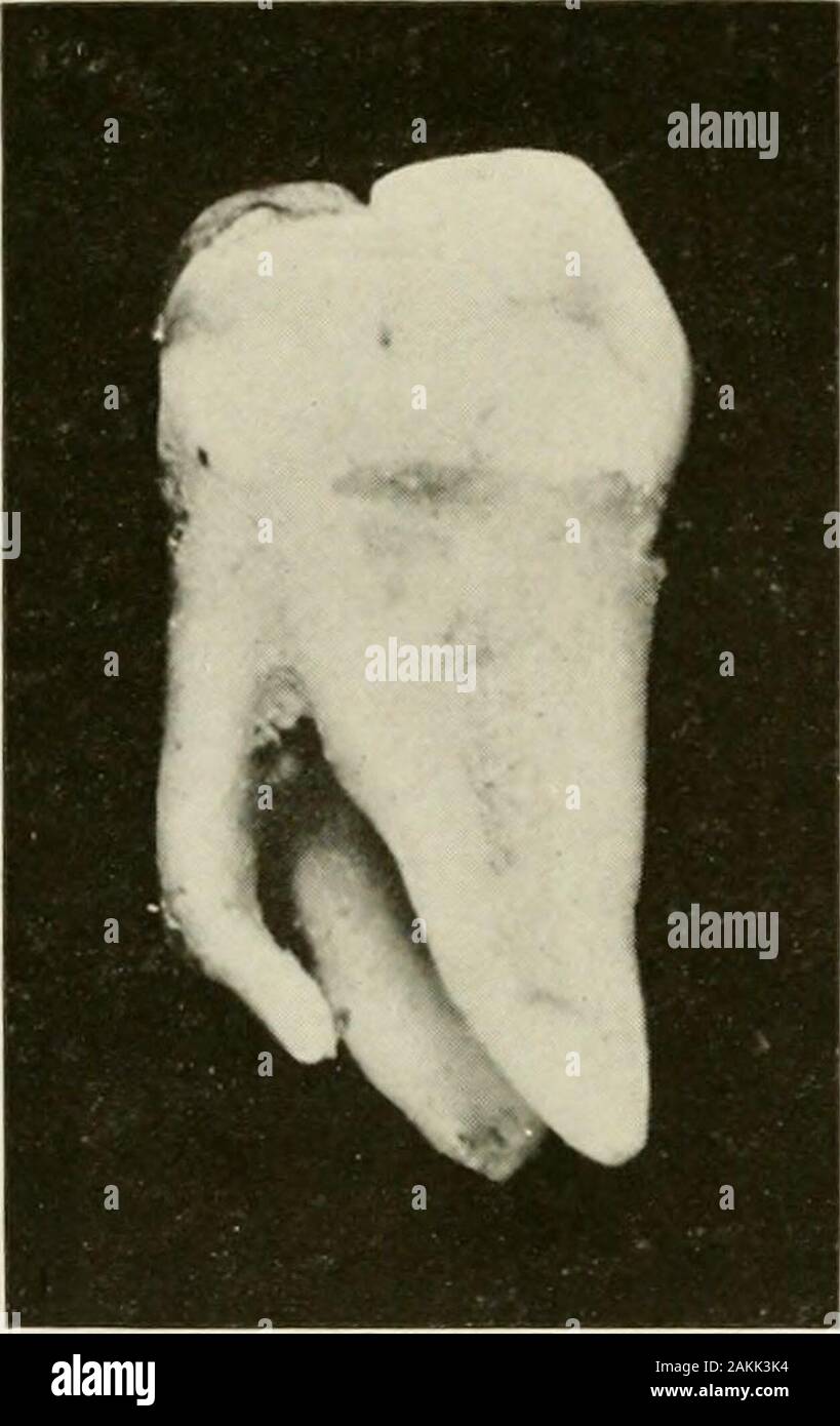 General and dental pathology with special reference to etiology and ...