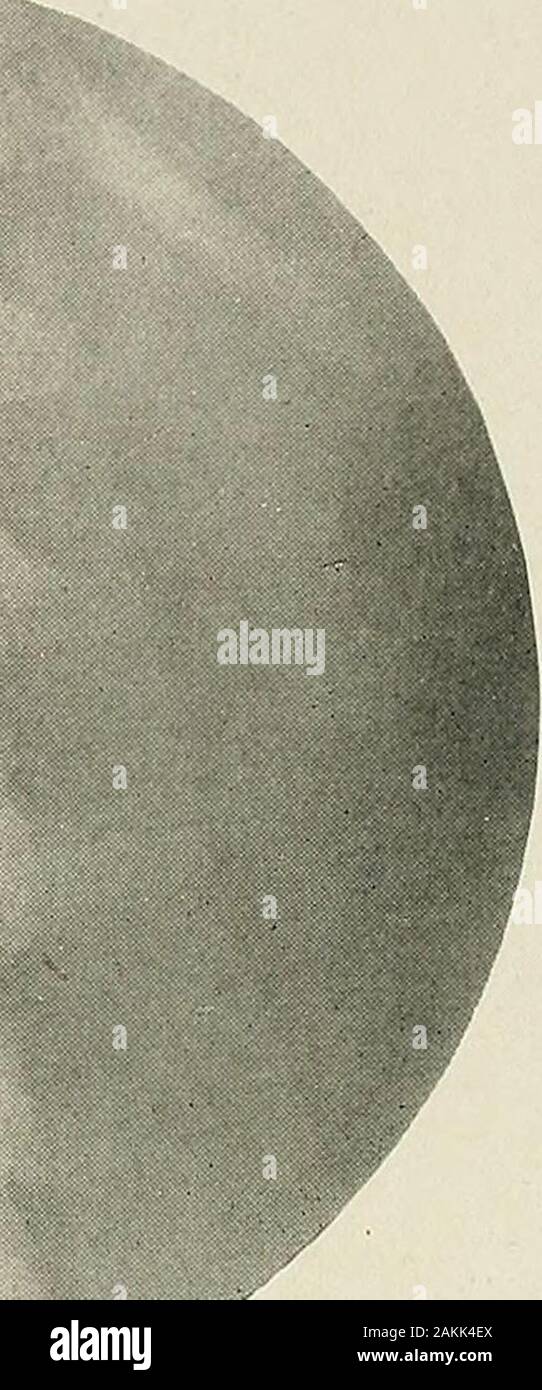 Pyelography (pyelo-ureterography) a study of the normal and pathologic ...